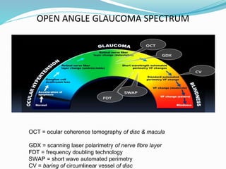 GLAUCOMA | PPT