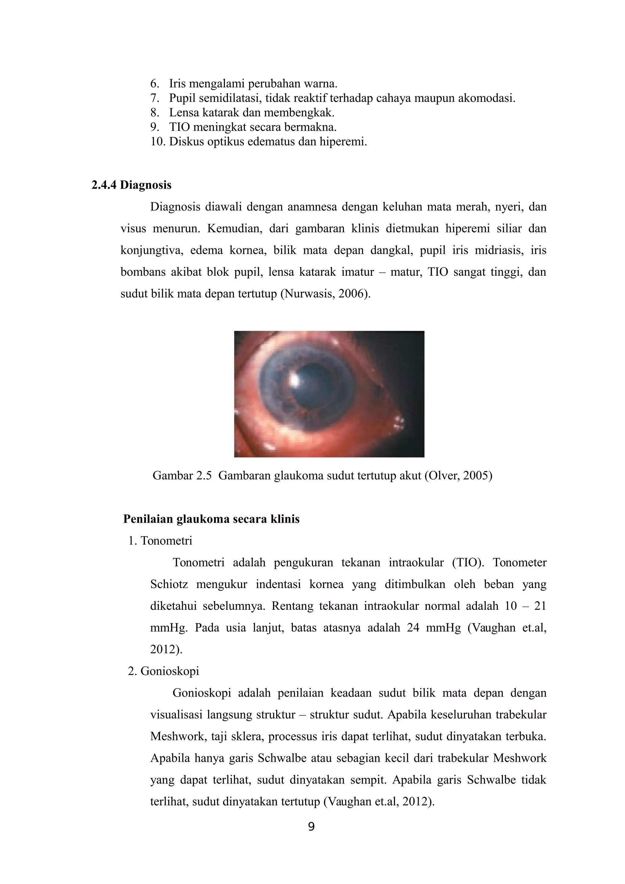 Glaukoma Fakomorfik.pdf