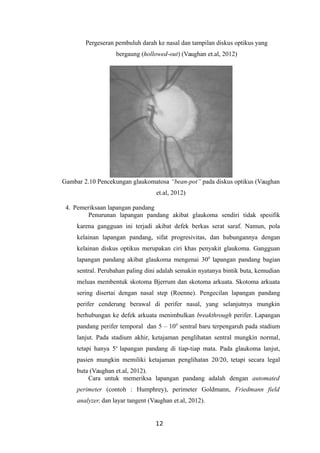 Glaukoma Fakomorfik.pdf