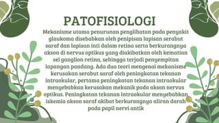 GLAUKOMA MATERI UNIVERSITAS AISYIYAH SURAKARTA | PPT