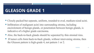 gleason classifaction histopathology and scoring | PPTX