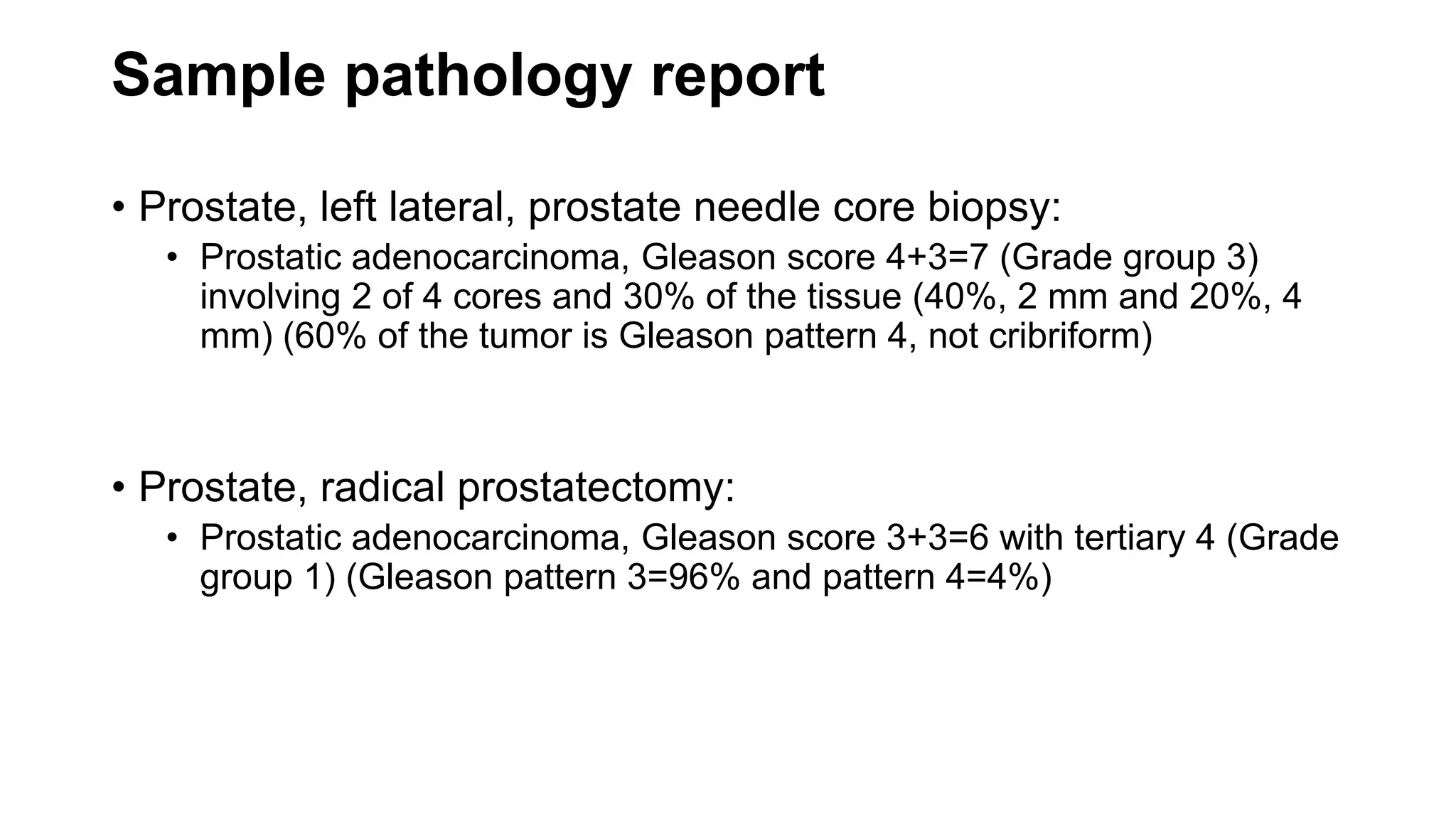 Gleason Grading of Prostate Cancer.pptx
