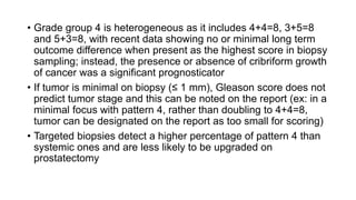 Gleason Grading of Prostate Cancer.pptx