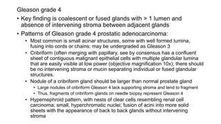 Gleason Grading of Prostate Cancer.pptx