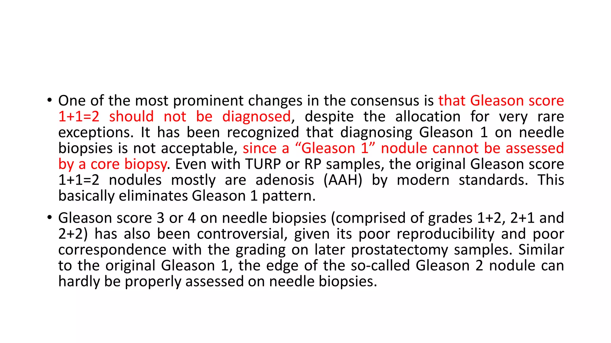 Gleason grading system | PPTX