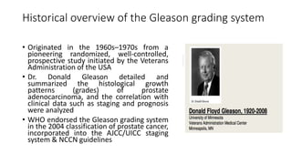 Gleason grading system | PPTX