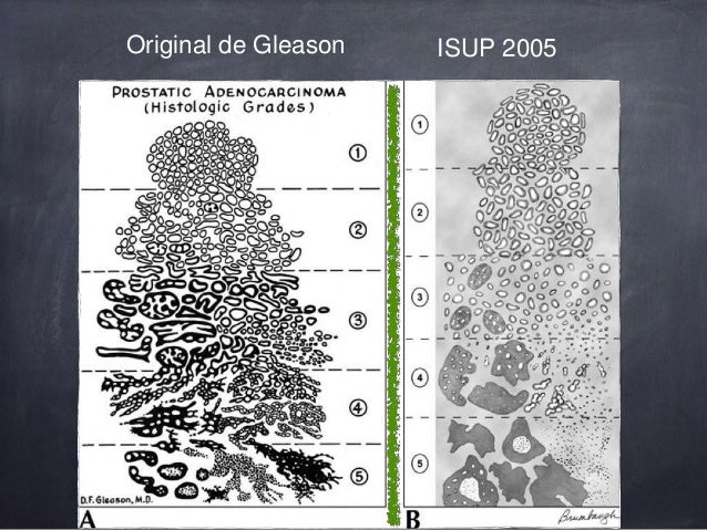 Mapa De Gleason