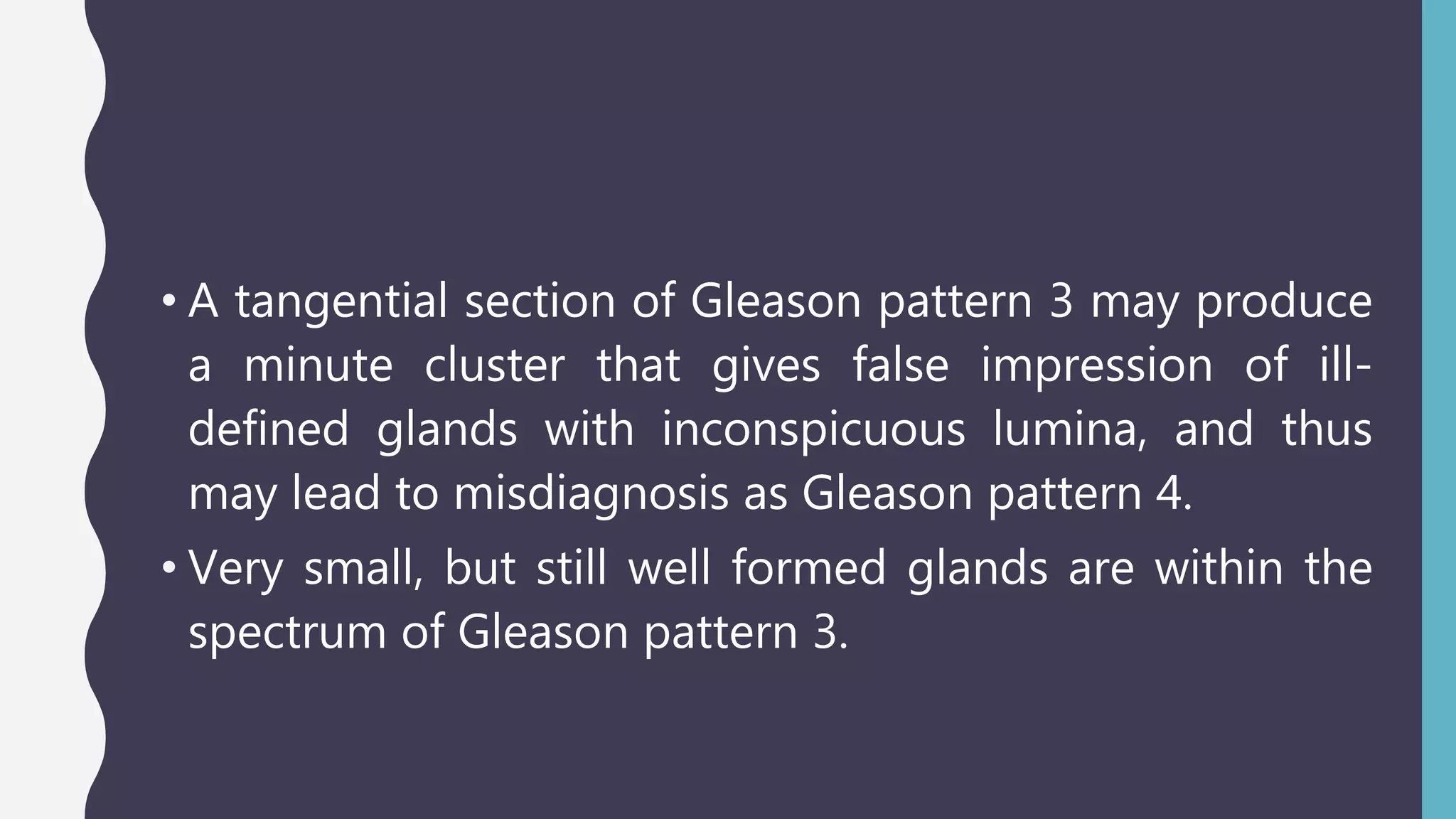 Gleasons scoring system | PPTX