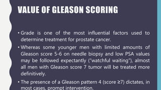 Gleasons scoring system | PPT