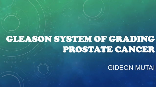 Gleason system of grading prostate cancer | PPTX | Cancer | Diseases ...