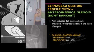 Glenohumeral instability Radiological evaluation - Dr Srivatsa Gumma | PDF