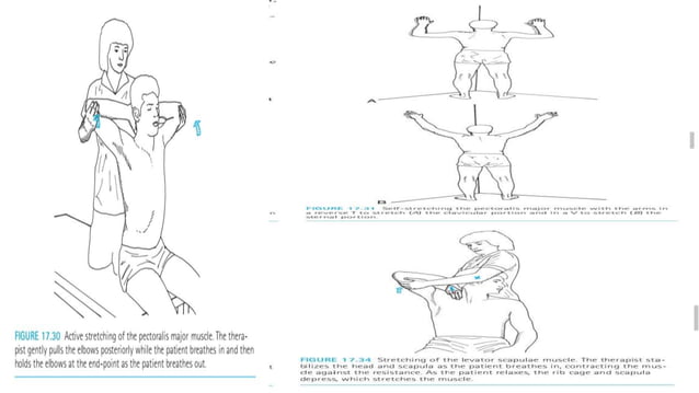 Glenohumeral Joint Hypomobility Management.pptx