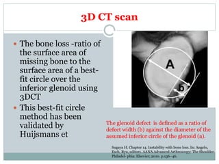 Assessment Of Glenoid Bone Loss In Recurrent Shoulder Dislocation | PPTX
