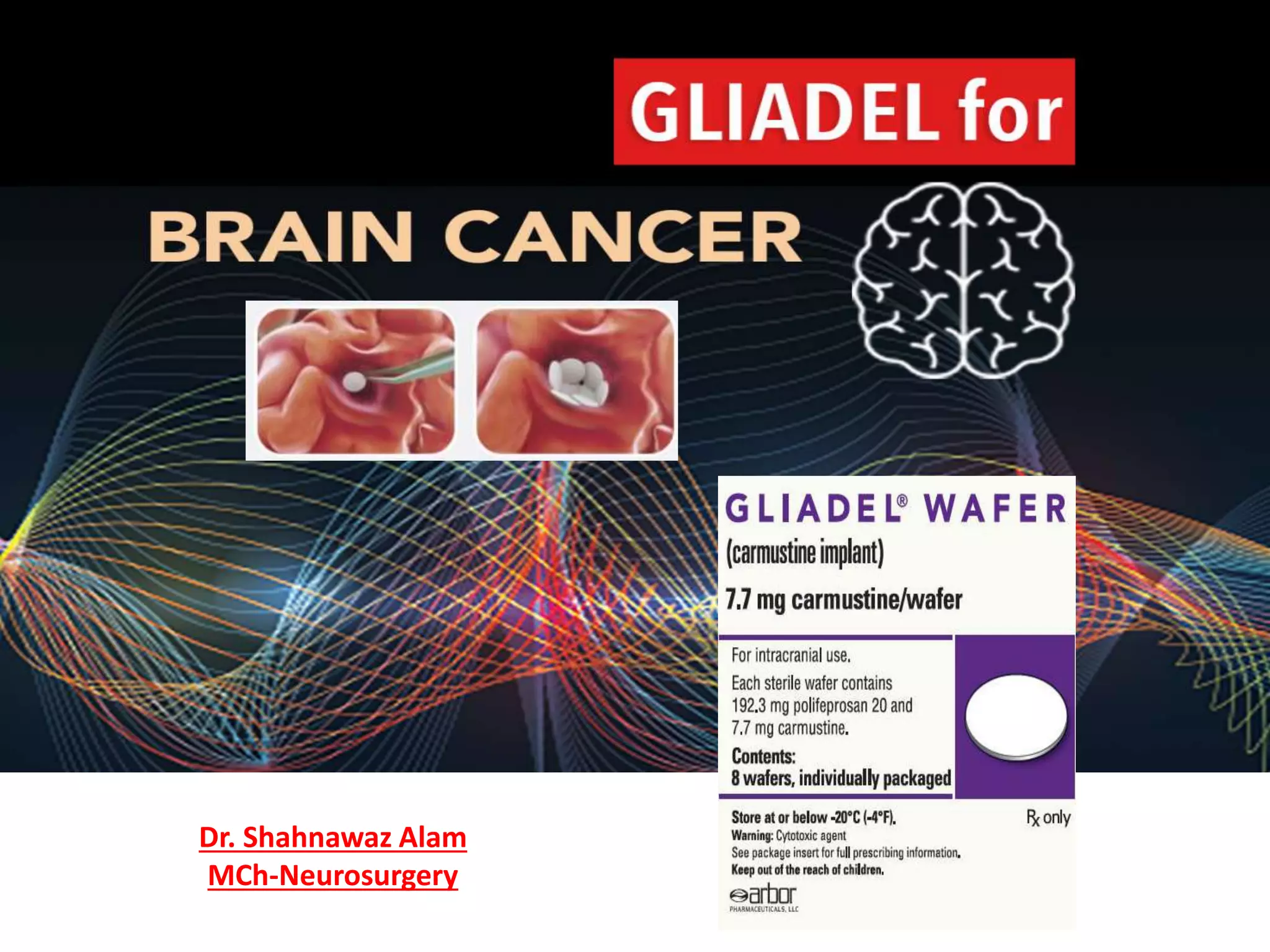 Gliadel wafer for GBM | PPTX