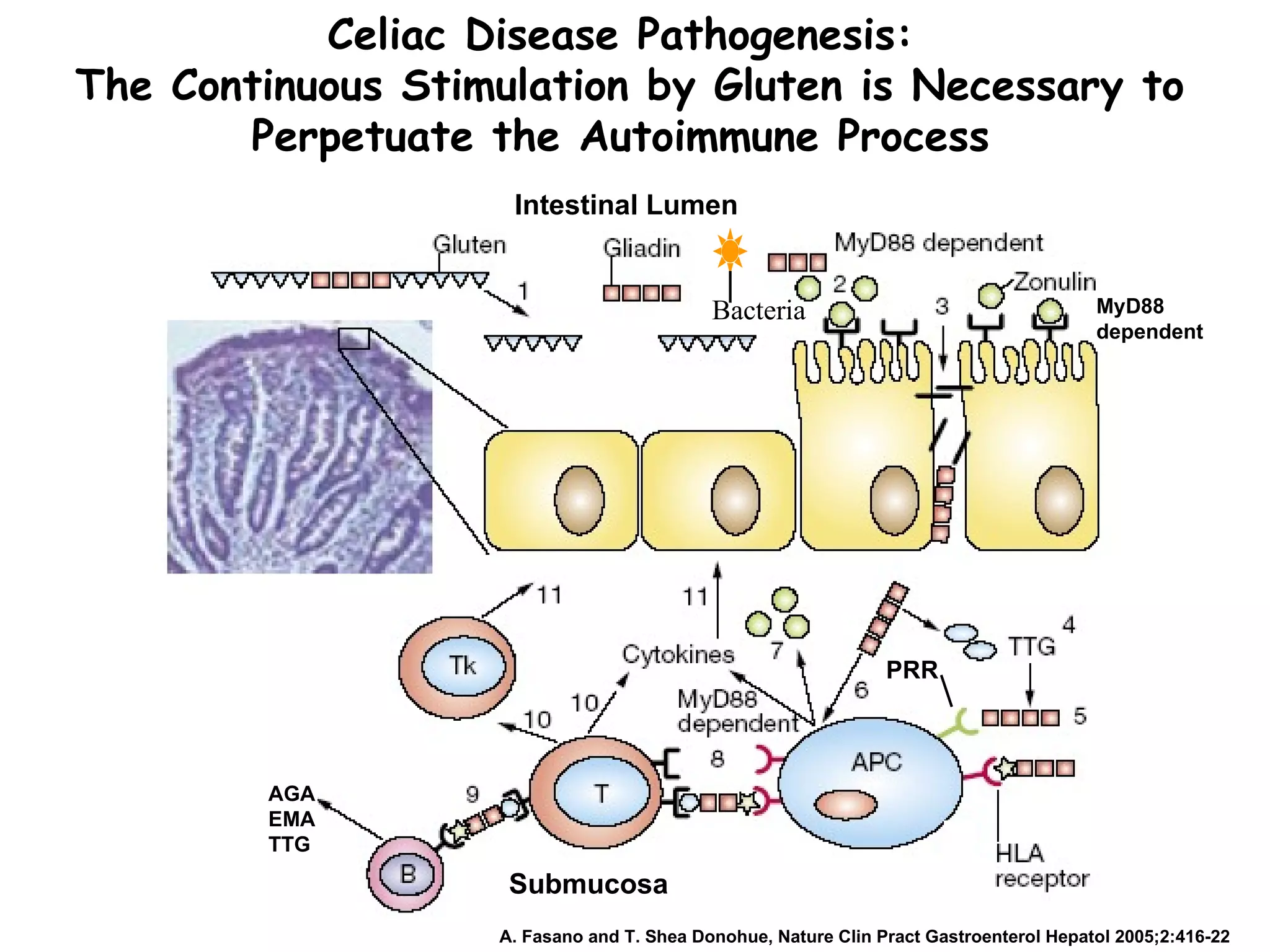 Gliadin, Intestinal Permeability, and Celiac Disease: From Innate ...