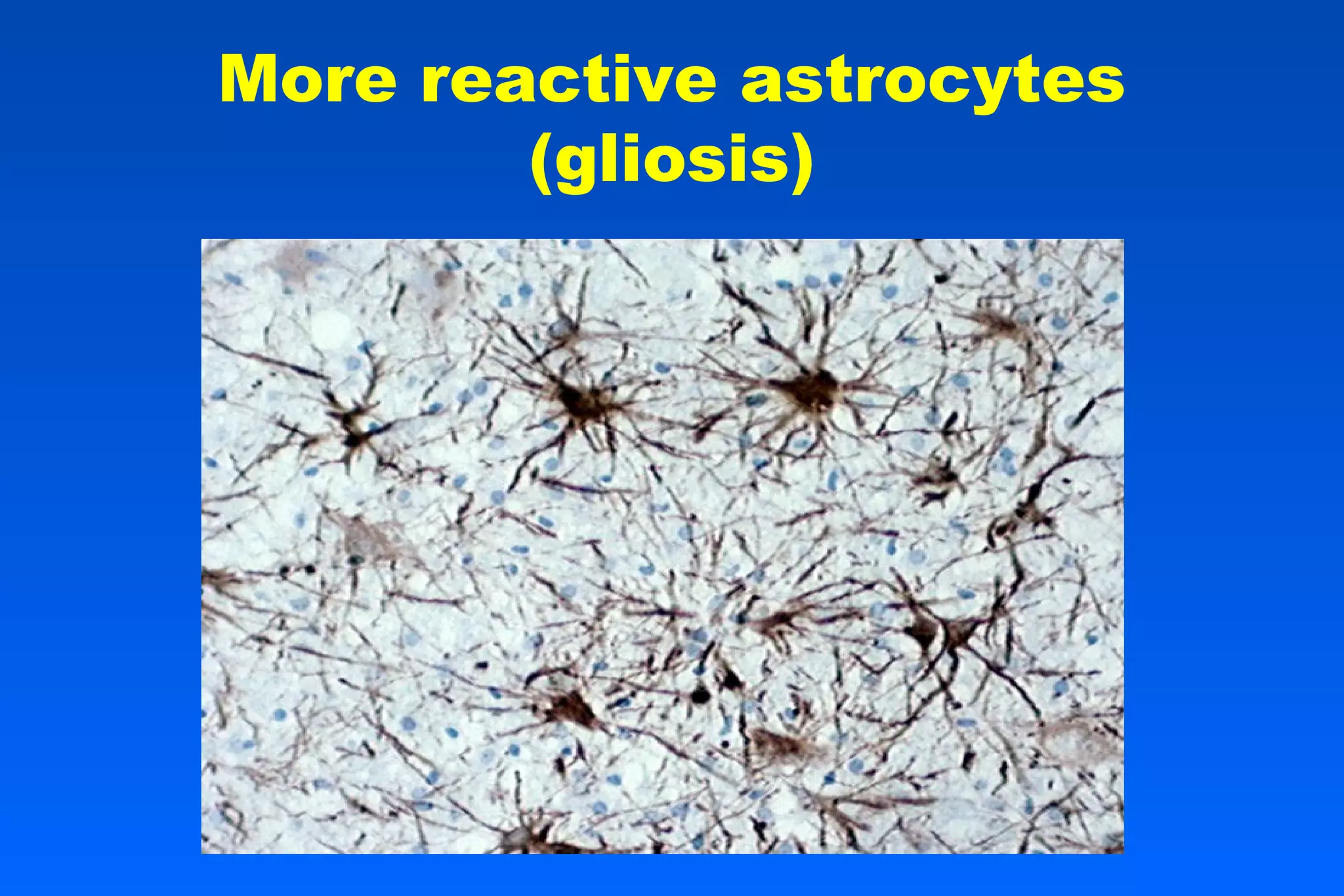 Glial cells - Neurobiology and Clinical Aspects | PPT