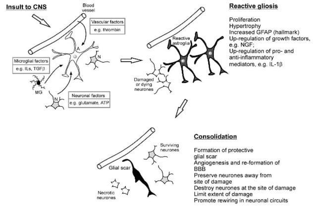 Glial cells - Neurobiology and Clinical Aspects | PPT | Brain and ...