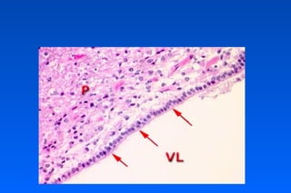 Neuroglia Slide