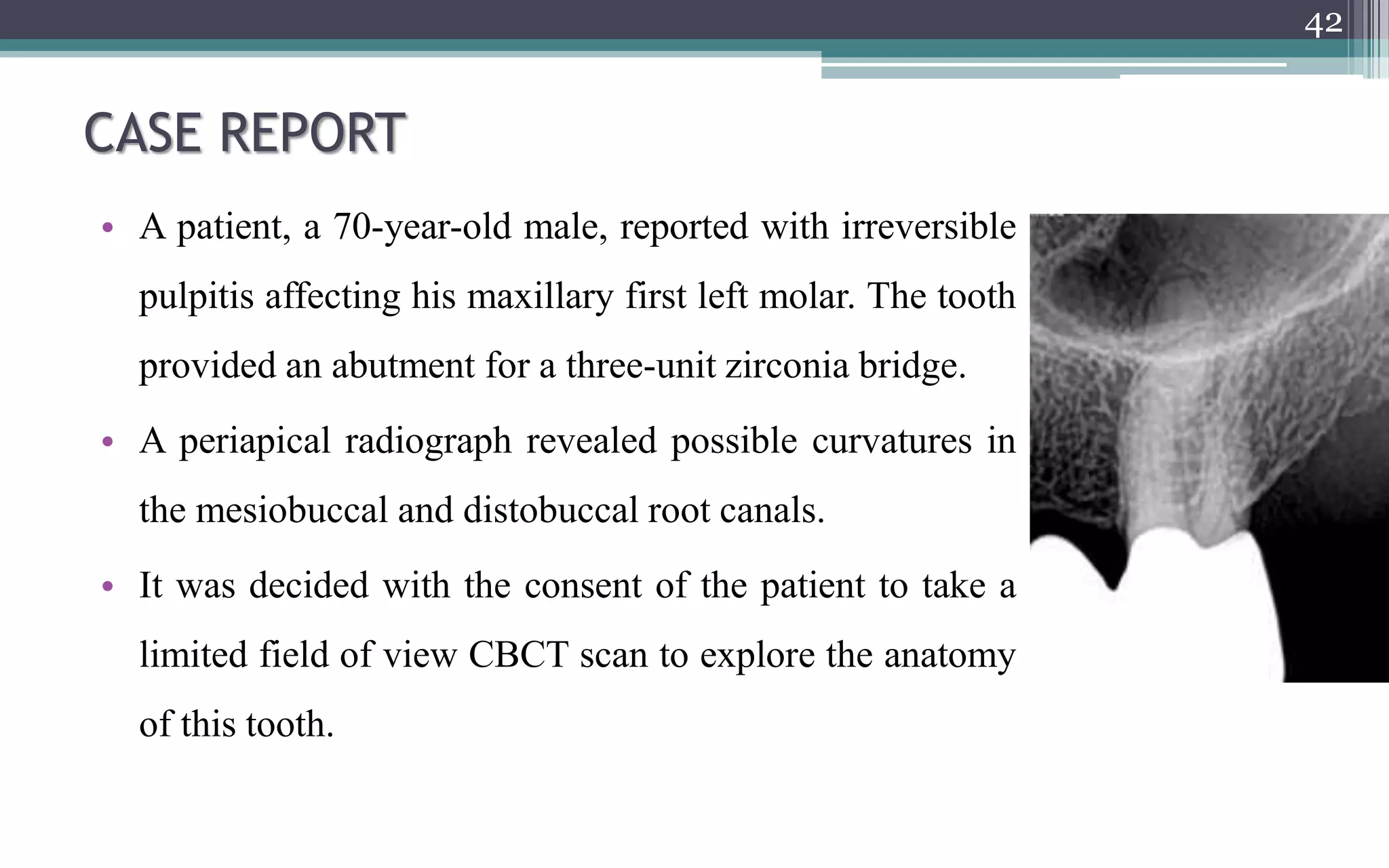 Glide path in endodontics | PPTX