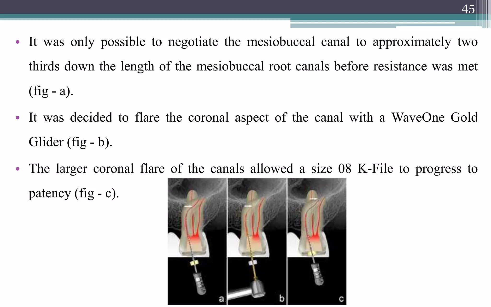 Glide path in endodontics | PPTX
