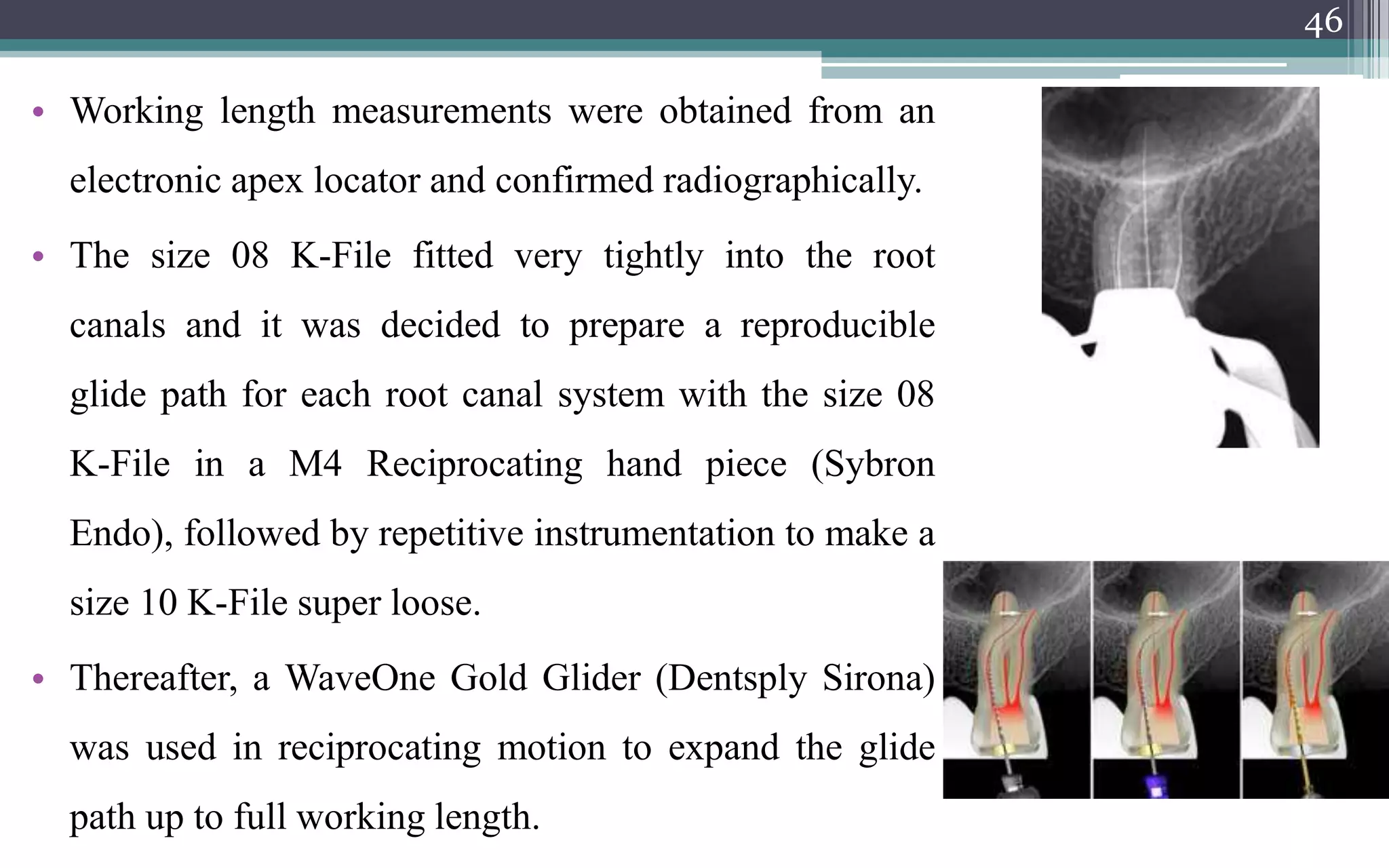 Glide path in endodontics | PPTX