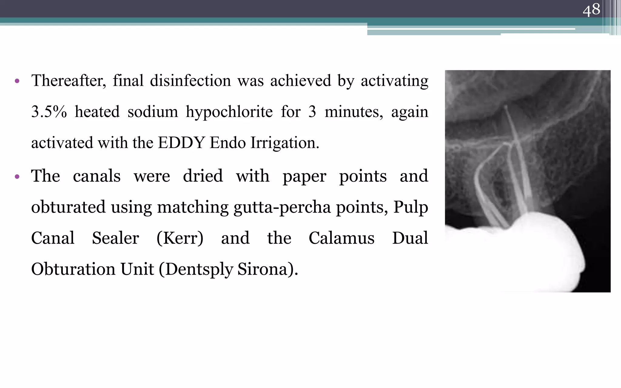Glide path in endodontics | PPTX