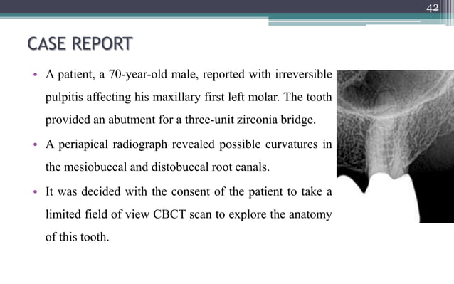 Glide path in endodontics | PPTX