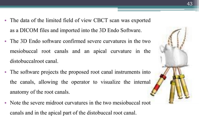Glide path in endodontics | PPTX