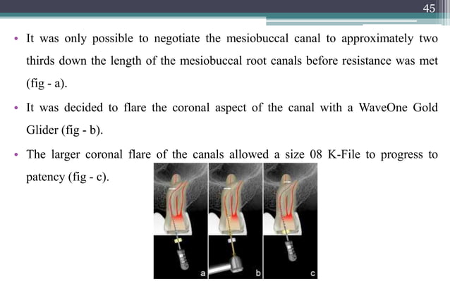 Glide path in endodontics | PPTX