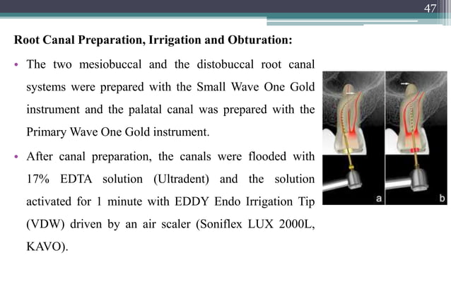 Glide path in endodontics | PPTX