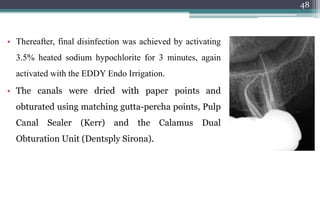 Glide path in endodontics | PPTX