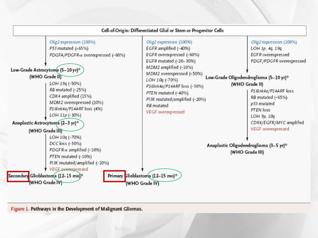 Chẩn đoán hình ảnh Glioblastoma (GBM) | PPT | Cancer | Diseases and ...