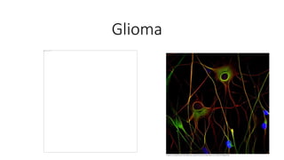 Glioma.pptx