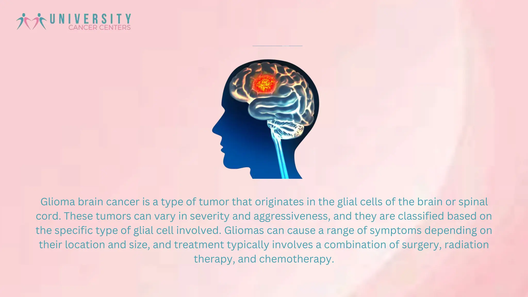 Glioma Brain Cancer-Types, Symptoms & Causes | PPT