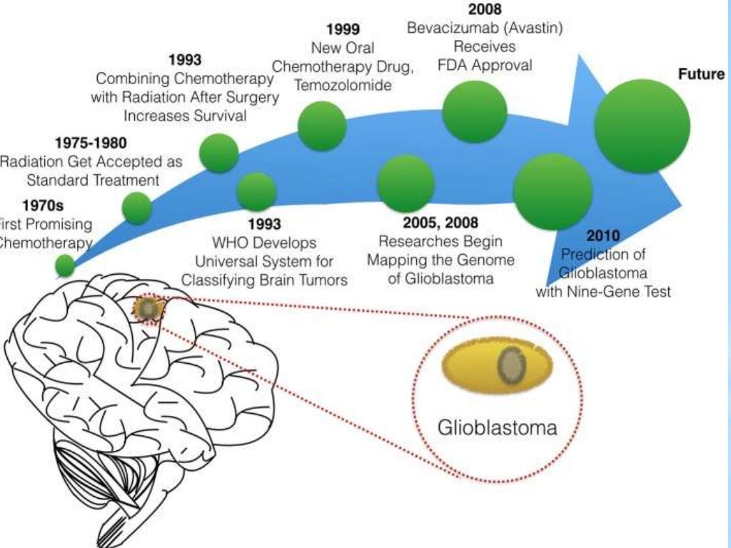 Gliomas - Brain Tumor