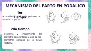 PARTO PODALICO mecanismo de parto podalico | PPTX