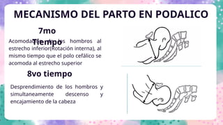 PARTO PODALICO mecanismo de parto podalico | PPTX