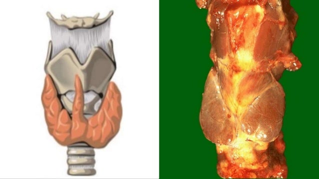 Anatomía de la Glándula Tiroides