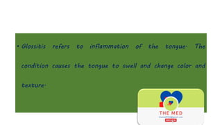 GLOSSITIS | PPTX