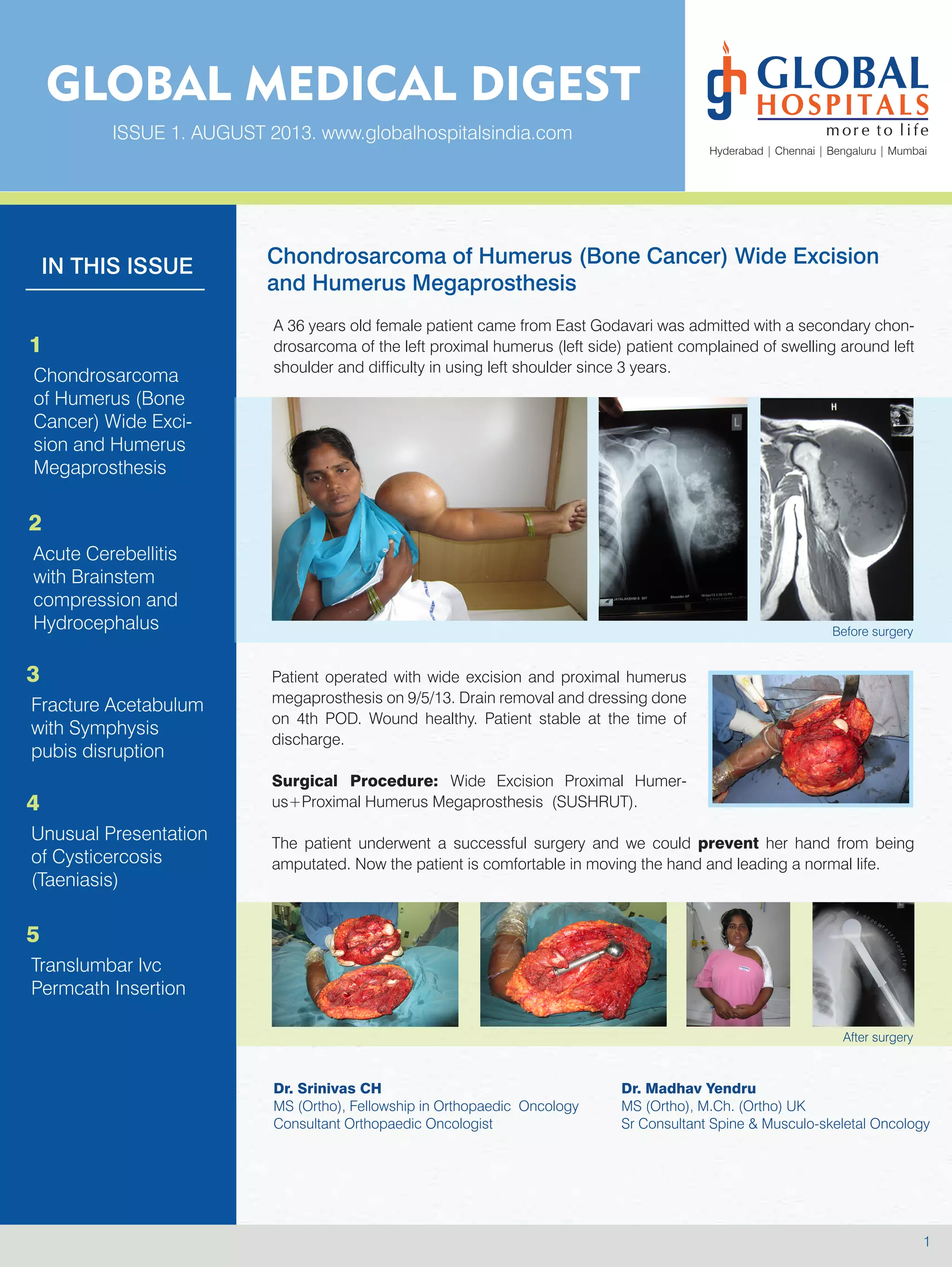 Global hospitals Medical Digest | PDF | Brain and Nervous System ...