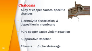 Chemical Injury & Foreign Body Ocular Injury | PPTX | Death, Injury, or ...