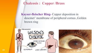 Chemical Injury & Foreign Body Ocular Injury | PPTX