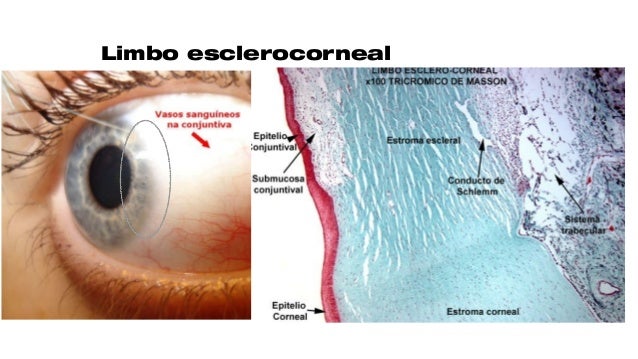 Globo ocular