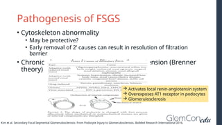 Glom Con: Basics of Focal Segmental Glomerulosclerosis (FSGS) | POTX