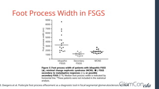 Glom Con: Basics of Focal Segmental Glomerulosclerosis (FSGS) | POTX