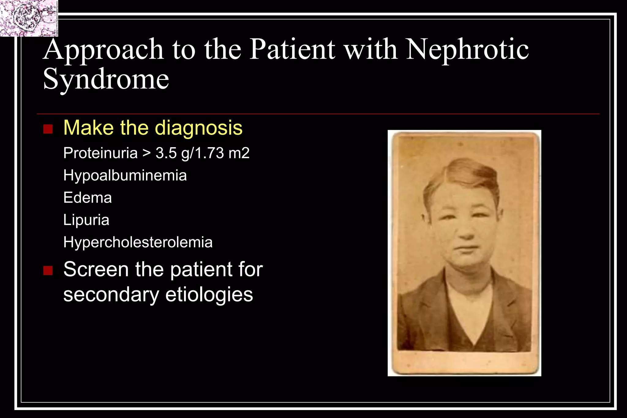 Glomerular-Diseases2.ppt