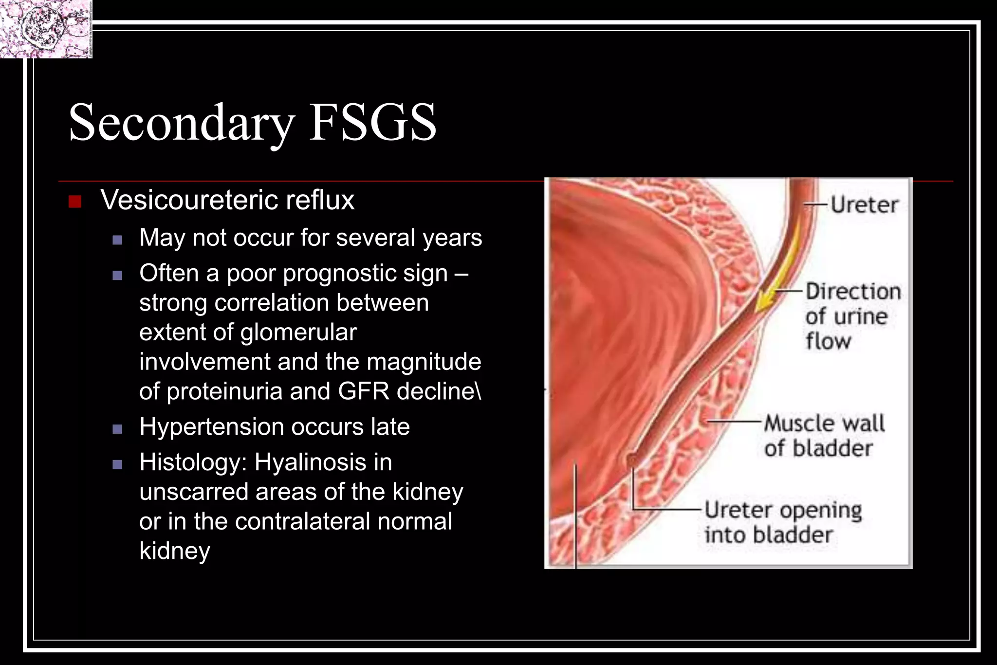 Glomerular-Diseases2.ppt