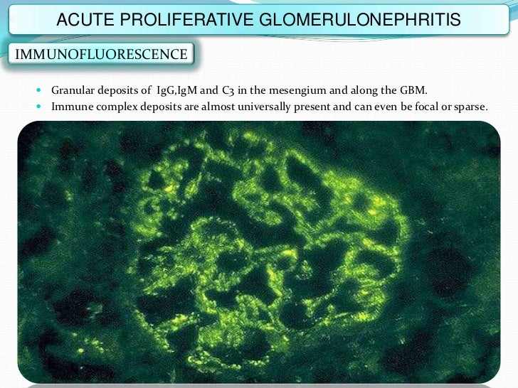 Glomerular diseases