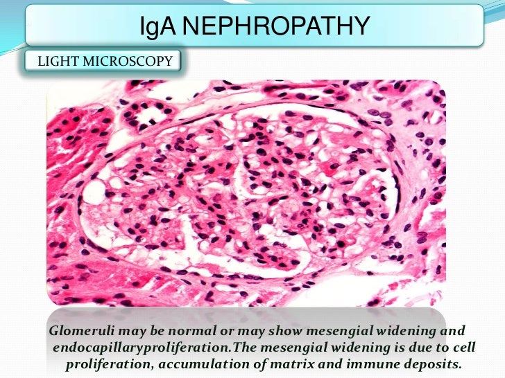Glomerular diseases
