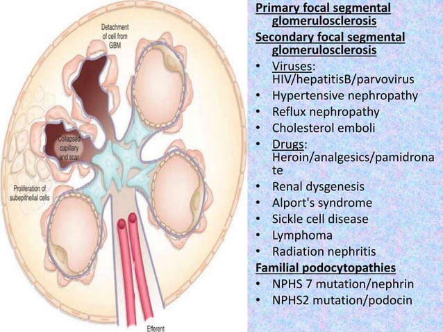 Glomerular diseases | PPTX